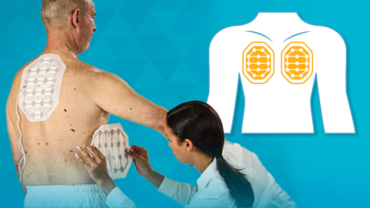 Novacure's Wearable Lung Cancer Treatment Device, Optune Lua, Receives ...